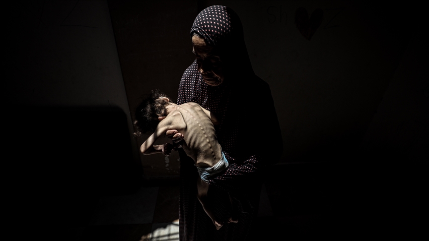 EXPLAINER – US lawmakers ramp up criticism of Israel’s starvation ...